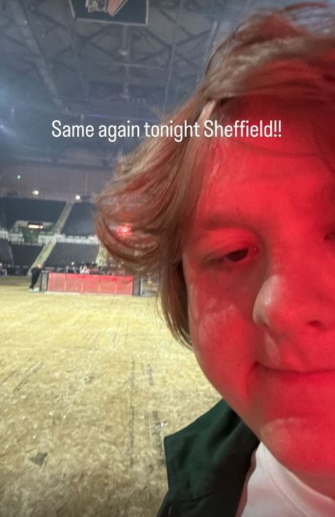 Lewis Capaldi returns to the stage after two years: how the concert ...