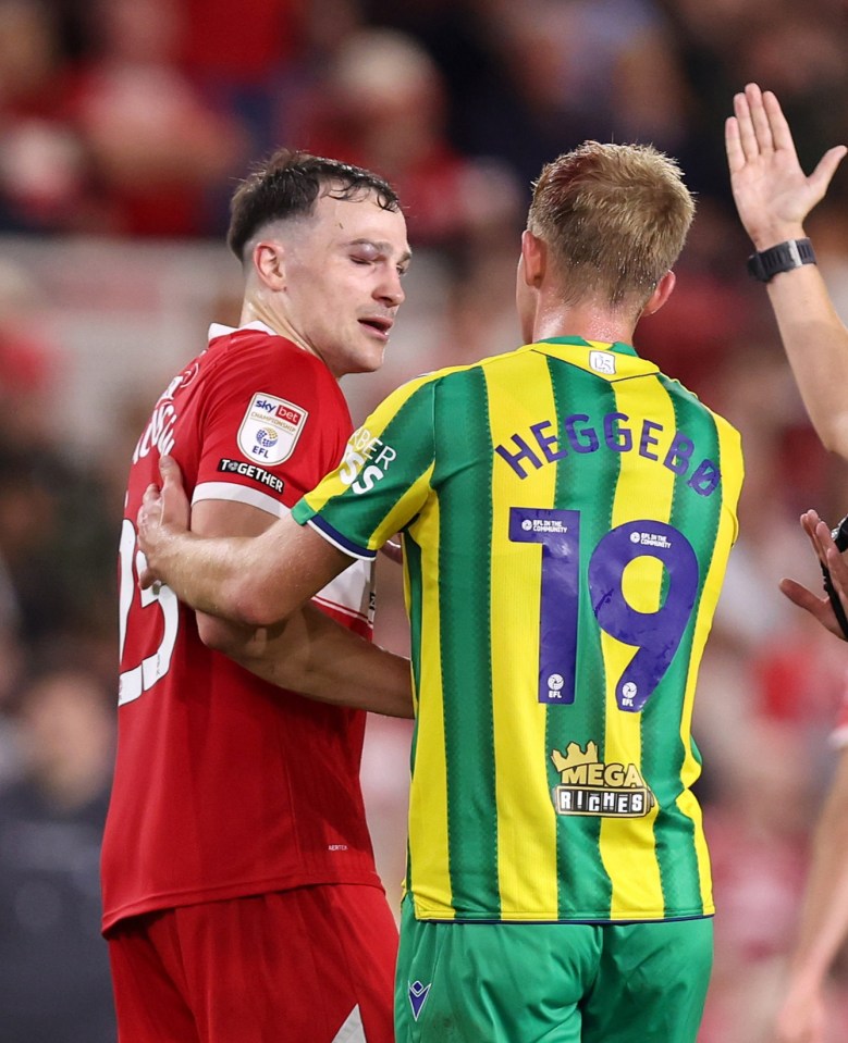 Footballer George Edmundson suffered a horrific eye injury during the ...